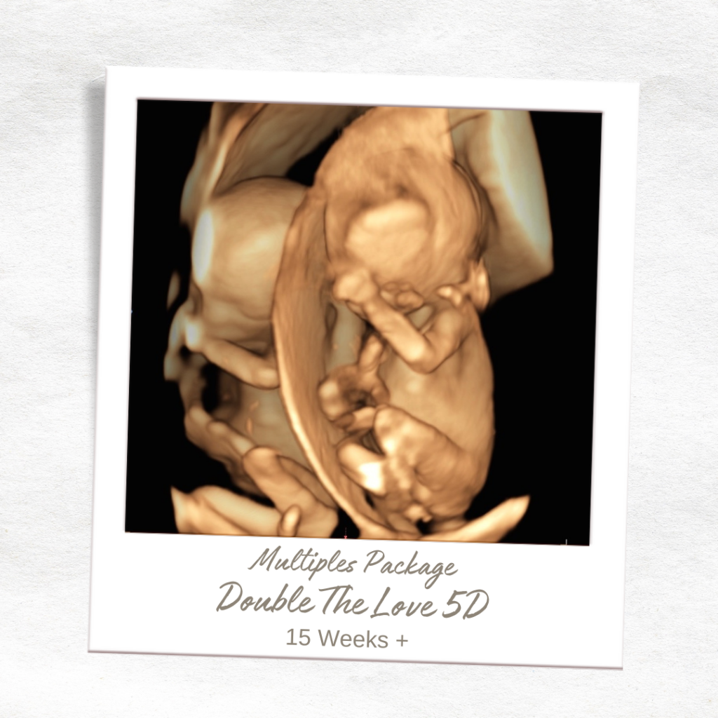 Double the Love (For Twins/Multiples) | 3D/4D/5D | Picture Me Baby Ultrasounds | Fayetteville NC